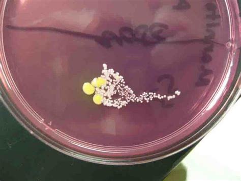 Staphylococcus Saprophyticus Colony Morphology