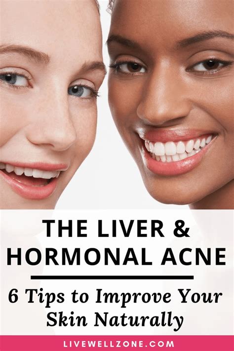 Liver And Hormonal Acne 6 Powerful Tips For Clear Skin Live Well