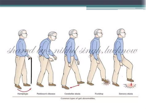 Gait Abnormalities Presentation Pptx