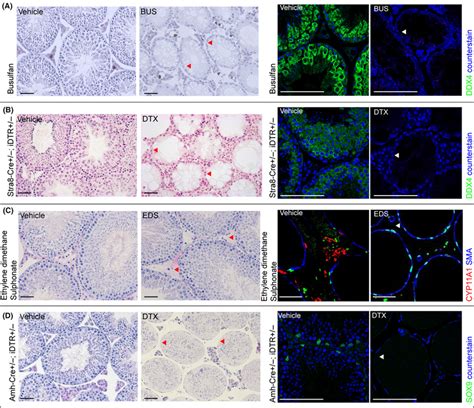 Cell Specific Ablation In The Testis Example Of Testis Histology And