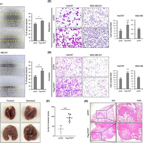 Pop7 Promotes Breast Cancer Cell Migration Invasion And Tumor