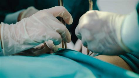 Understanding Loculated Pneumothorax Causes Symptoms And Treatment