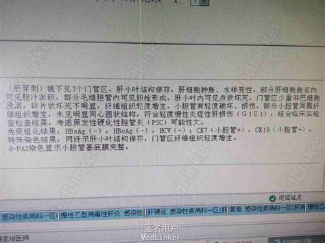 原发性硬化性胆管炎 医联