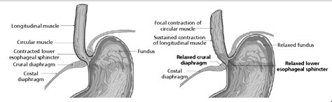 Esophageal Sphincter
