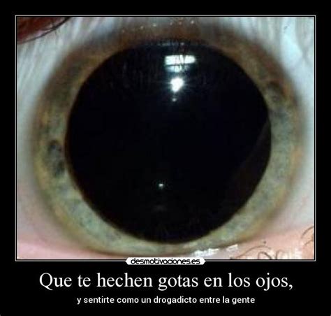 Que Te Hechen Gotas En Los Ojos Desmotivaciones