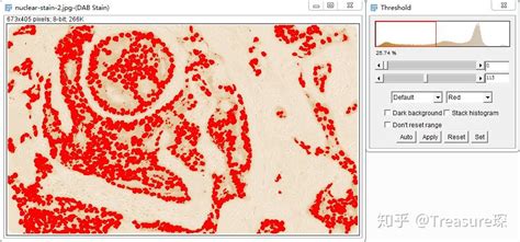 Imagej实用技巧——免疫组化分析定量分析篇 知乎 Imagej实用技巧——免疫组化分析定量分析篇 知乎