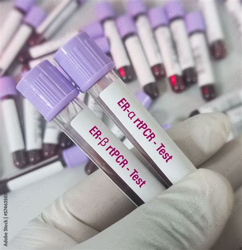 Blood sample for ERα Estrogen receptor α and ERβ Estrogen Receptors β rtPCR testing It s