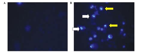 Effects Of Acetaminophen APAP Treatment On Nuclear Condensation And Download Scientific