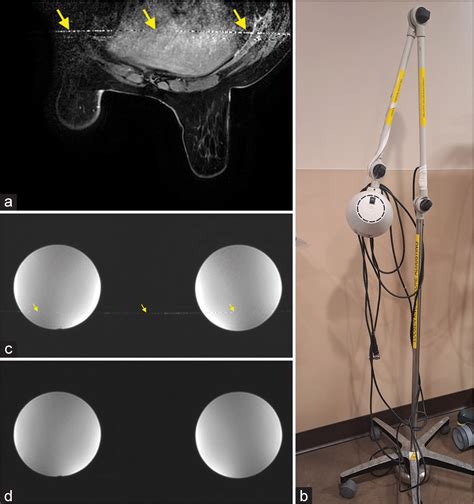 Radiofrequency Interference In Magnetic Resonance Imaging Identification And Rectification
