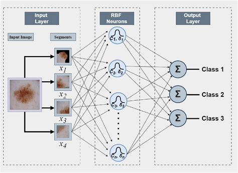 논문 리뷰 Hybrid Interpretable Deep Learning Framework For Skin Cancer Diagnosis Integrating