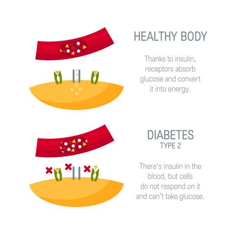 Insulin Resistance Illustrations Royalty Free Vector Graphics And Clip Art Istock