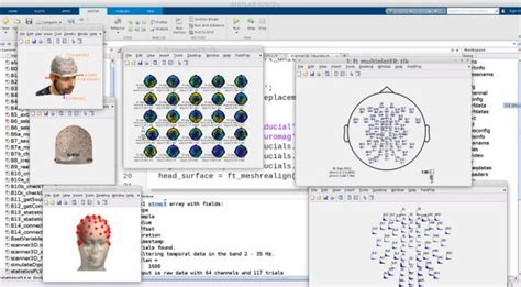 Deep Learning Decodes Brain Signals To Identify Adhd Matlab And Simulink
