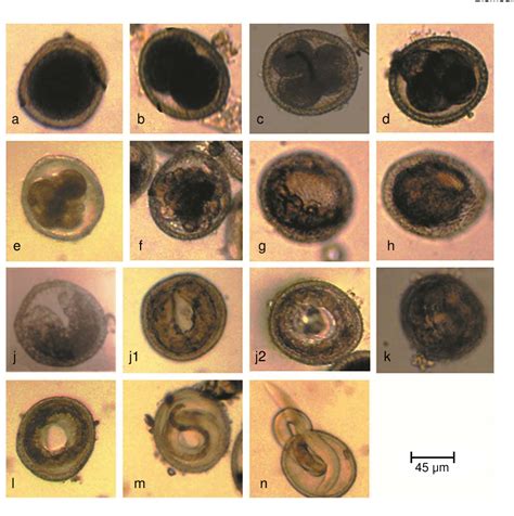Figure 1 From [developmental Stages And Viability Of Toxocara Canis Eggs Outside The Host