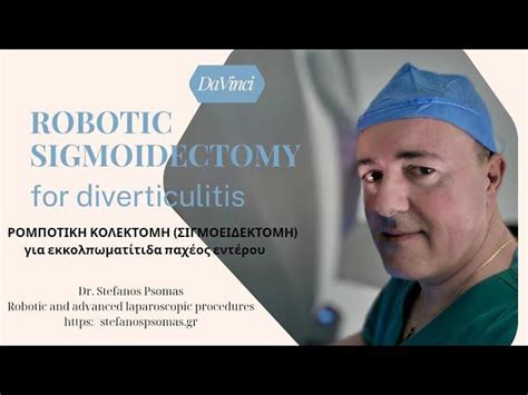 Robotic Sigmoidectomy For Diverticulitis Ρομποτική σιγμοειδεκτομή για