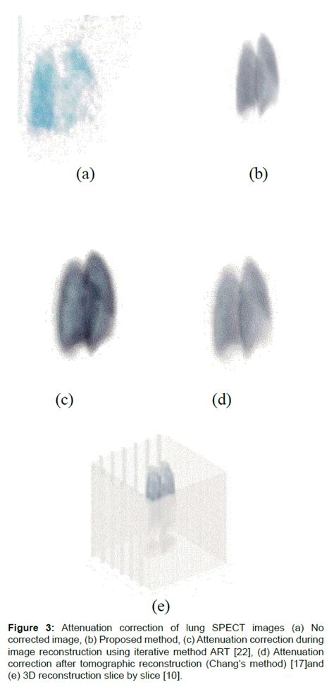 Accurate 3d Attenuation Map For Spect Images Reconstruction