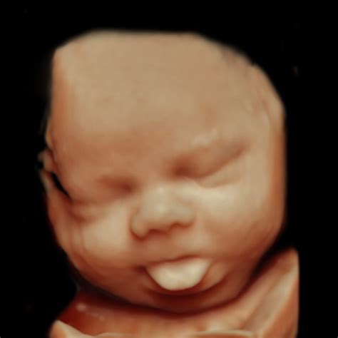 30 Weeks Pregnant 4d Ultrasound
