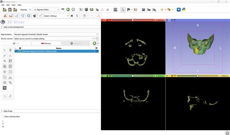 How To Substract Two Stl Files Support 3d Slicer Community