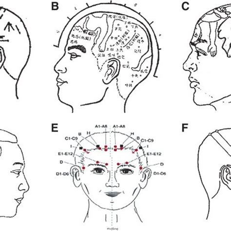 Illustrations Of Different Scalp Acupuncture Theories A Jiao Shunfa