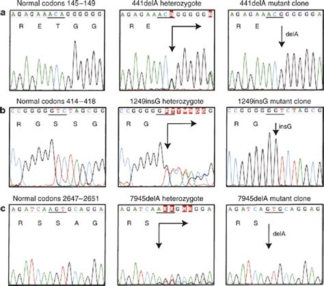 Frameshift Mutations Of Patients With Iv A Direct Dna Sequencing Of