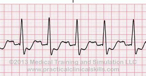 Bbb Vtachvfib Album On Imgur