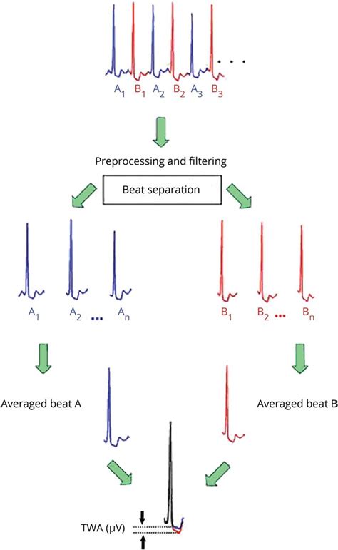 Modified Moving Average Technique For Detection Of T Wave Alternans Twa Download Scientific