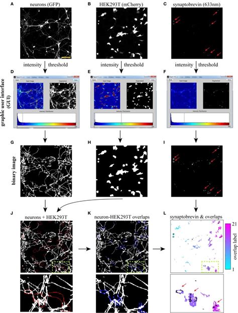 Workflow For Computer Assisted Segmentation Of Presynaptic Clusters Download Scientific