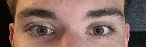 Attempted Waxing My Unibrow For The First Time Is It Okay Or Should I Get It Fixed R