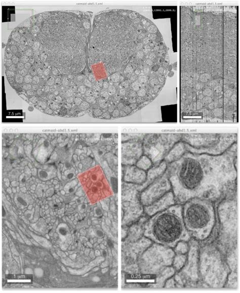 Neubias Academy Home Neubias Network Of Bioimage Analysts