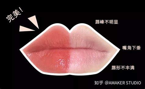 A家攻略丨你不满意的唇形不开刀也能变完美哟 知乎