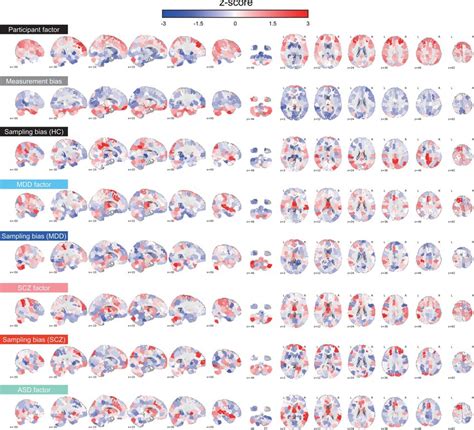 Spatial Distribution Of Each Type Of Bias And Each Factor In Various Download Scientific