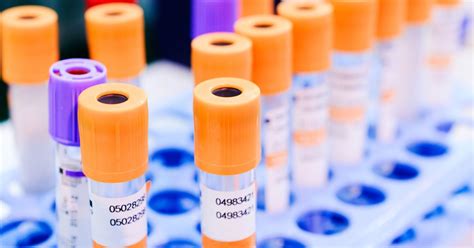 Hepatitis C Screening Is For Everyone Sharecare