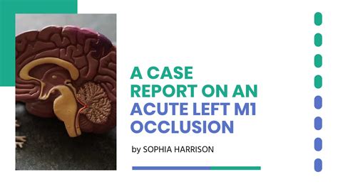 Internship Report Presentation Template Google Slides Apple Keynote PowerPoint Template Net