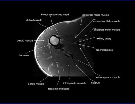 Axial Shoulder Anatomy Imaging Anatomy