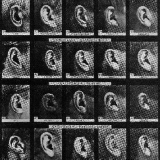 5 Classification Of The Shapes Of The Ear Here The Classification Of Download Scientific
