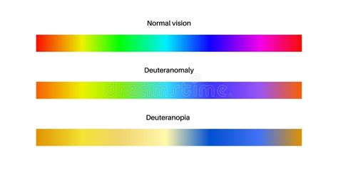 Deuteranomaly Deuteranopia Stock Illustrations 56 Deuteranomaly