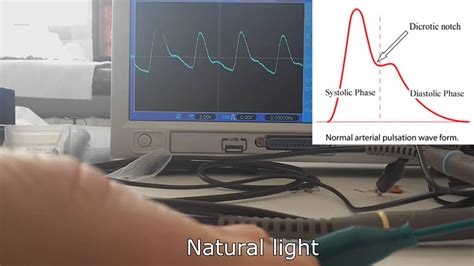 Diy Heart Rate Monitor With A Photoresistor And 2 Op Amps Youtube