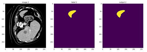 Tensorboardplugin3d Visualizing 3d Deep Learning Models In Tensorboard
