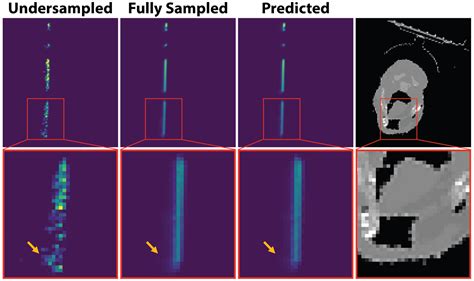 deep monte carlo dose denoising ryan neph