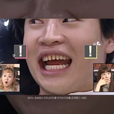 더쿠 안 한 연예인 없지만 다들 뜯어말린다는 수술
