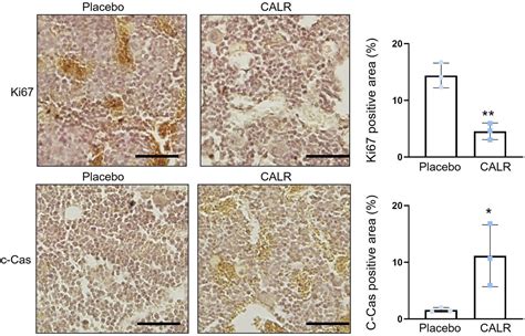 Figures And Data In Osteosarcoma Enriched Transcripts Paradoxically Generate Osteosarcoma