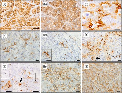 Immunohistochemical Study Of Hepatocyte Cholangiocyte And Stem Cell