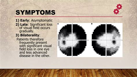 Primary Open Angle Glaucoma Pptx