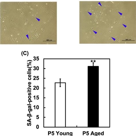 Percentage Of Senescent Cells In Human Gingival Fibroblast Cultures Download Scientific