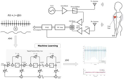 Signal Processing Chain For Time Series Heartbeat Reconstruction With