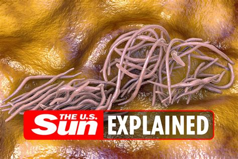 Pin Worms In Humans Anus
