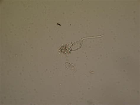 Phytophthora Cactorum Phytophthora Root Rot