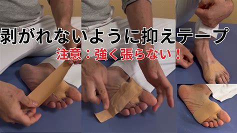 足の親指の付け根（母指球）の痛みを自分で治すテーピング法を解説