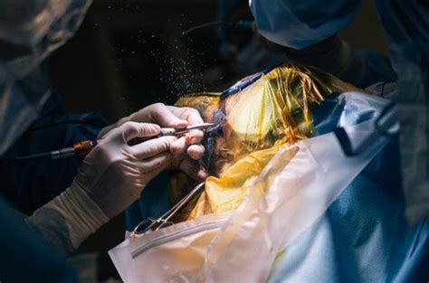 УГТЭ Уналт таталтын мэс заслын эмчилгээг бие даан хийж байна