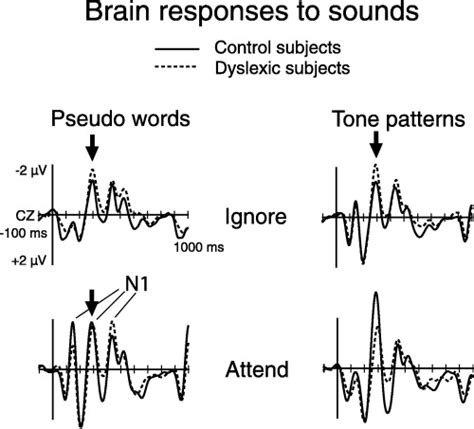 Brain Responses Elicited By Standard Pseudo Word And Tone Pattern