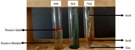 The Results Of Identification Of Escherichia Coli Bacteria On Sulfide